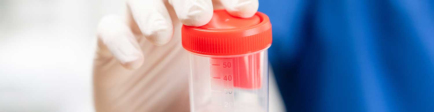 Drug-and-Alcohol-testing-for-cdl-drivers | BIS Safety Software